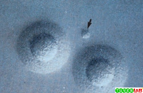 [Microbiology] Atlas of Mycoplasma and Ureaplasma | Free Medical Atlas