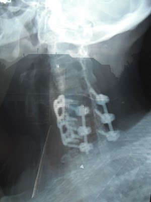 FINDING LANA: #53 - Broken Neck