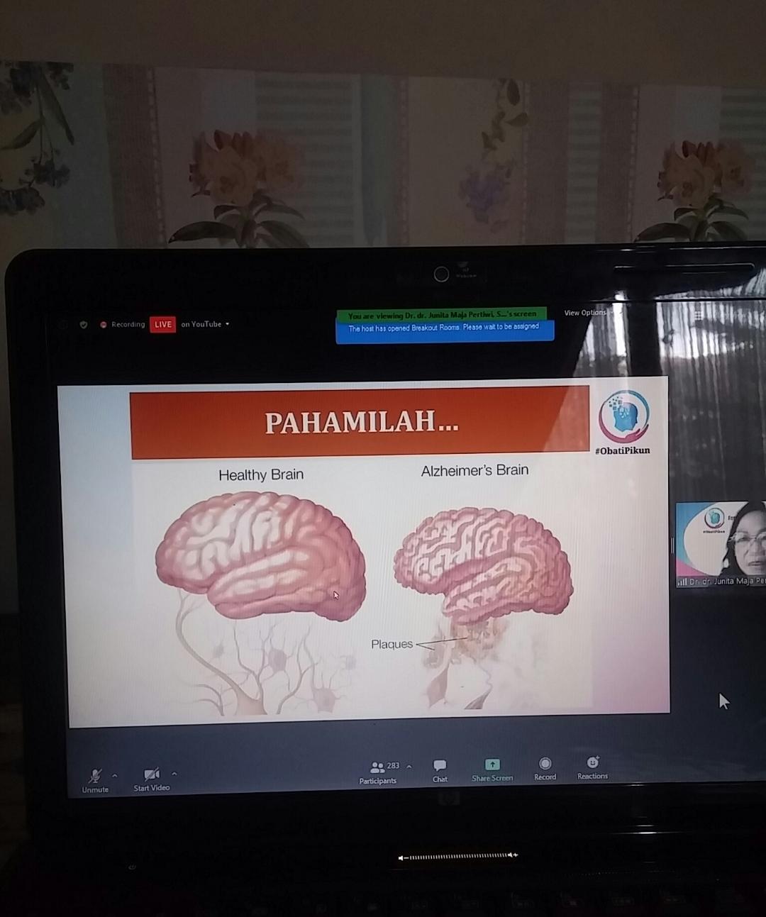 5 Fakta Tentang Pikun Yang Harus Diketahui