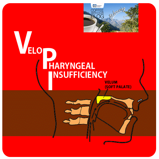 Velopharyngeal insufficiency (VPI) - Richardson dental and craniofacial ...