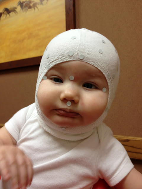 Duce Family: Brachycephaly