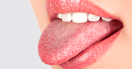 Remedios caseros para curar la candidiasis oral | Soluciones Caseras ...