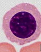 Atlas de Hematologia: Serie Roja: Eritroblasto Ortocromático