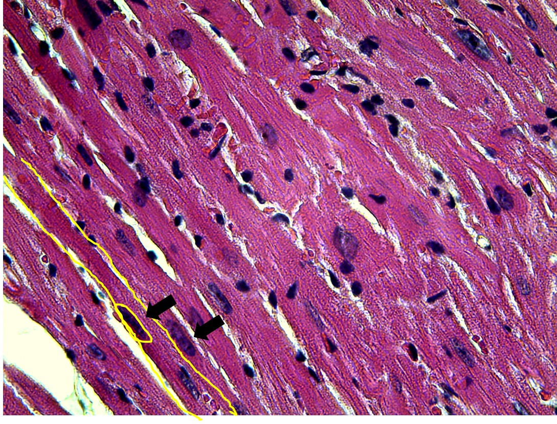 Micrografías de células cardíacas