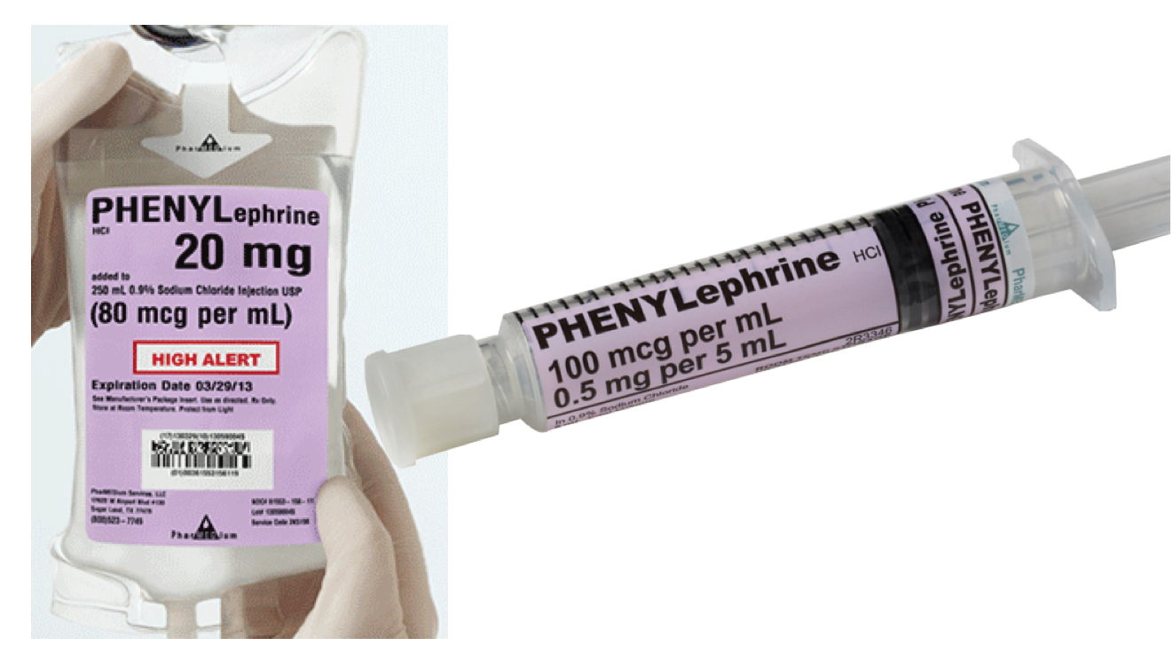 PHENYLEPHRINE VÀ EPHEDRINE DÙNG TRONG GÂY MÊ SẢN KHOA: QUAN ĐIỂM HIỆN ...