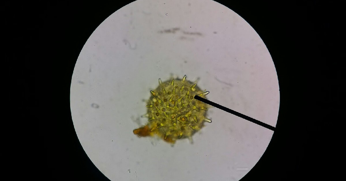 Biology: Penebalan Dinding Sel dan Plasmolisis