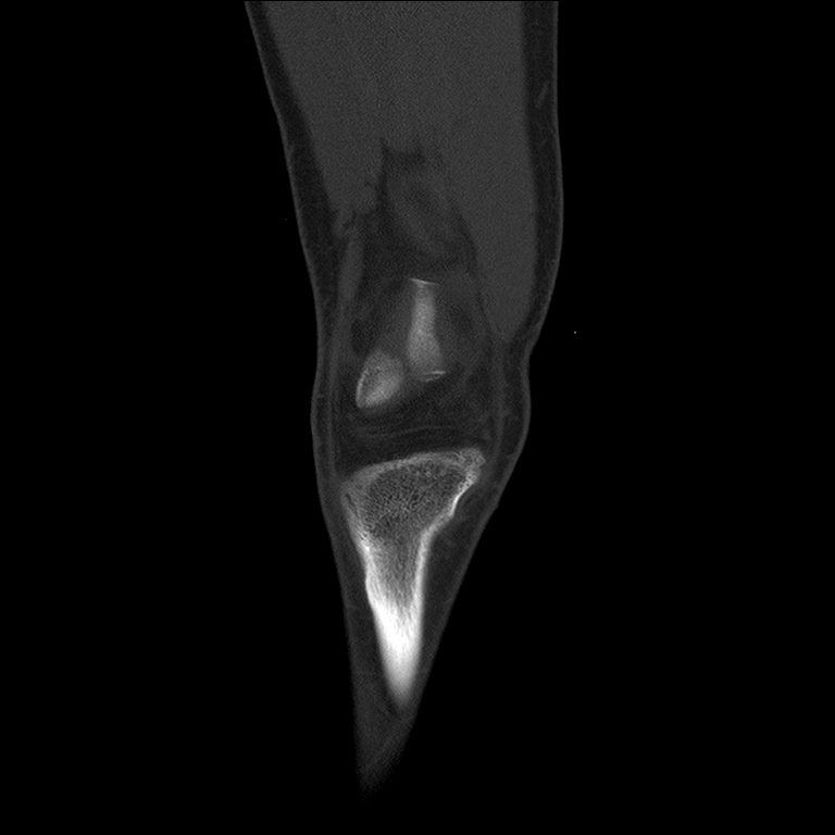 CT Knee - Radiology Imaging