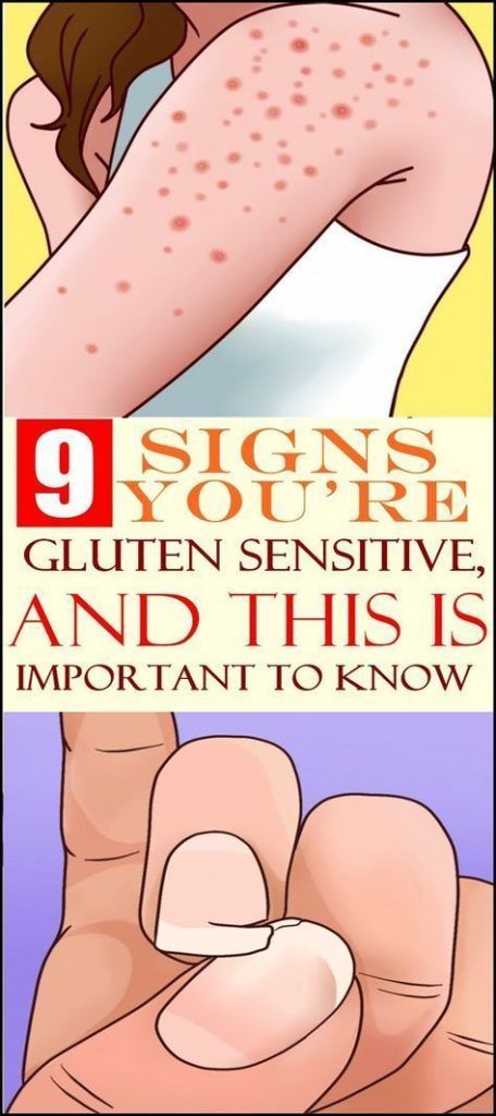 9 Signs You’re Gluten Sensitive, and This Is Important to Know ...