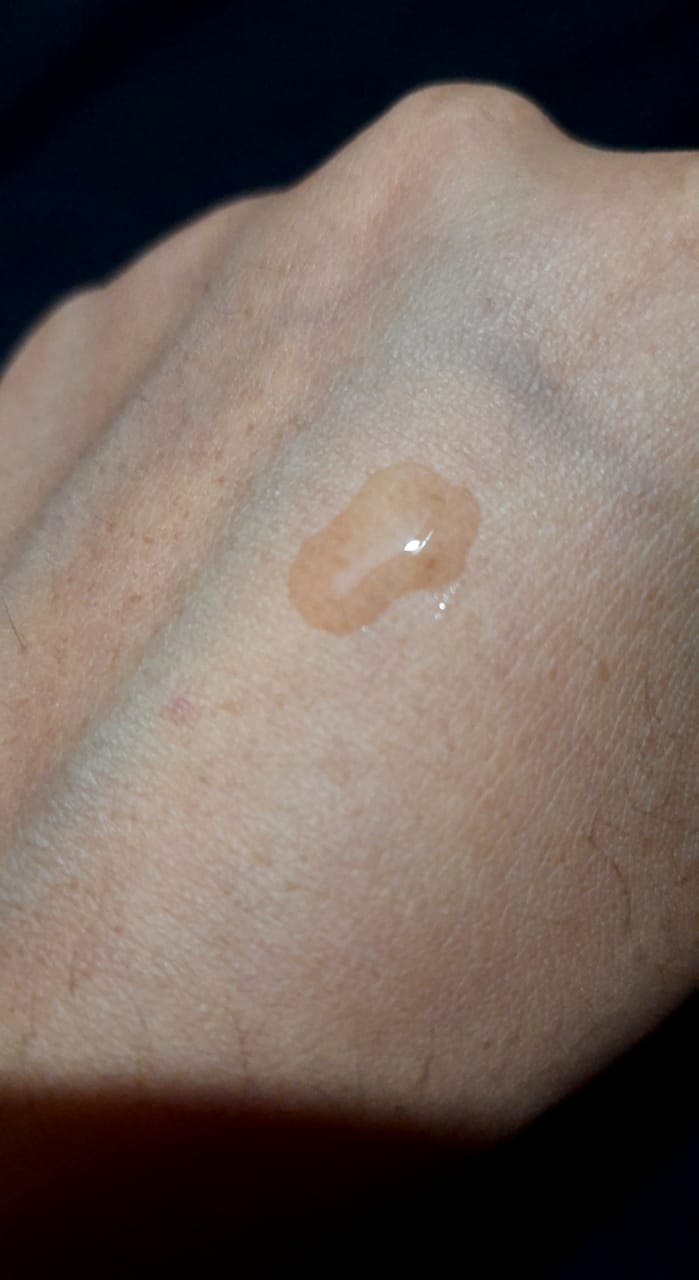 Erytop lotion review | Erytop | Clindamycin phosphate lotion for ...