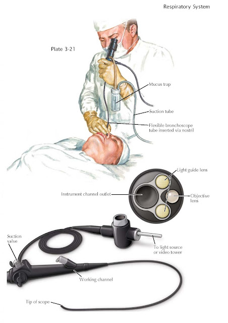 FLEXIBLE BRONCHOSCOPY - pediagenosis