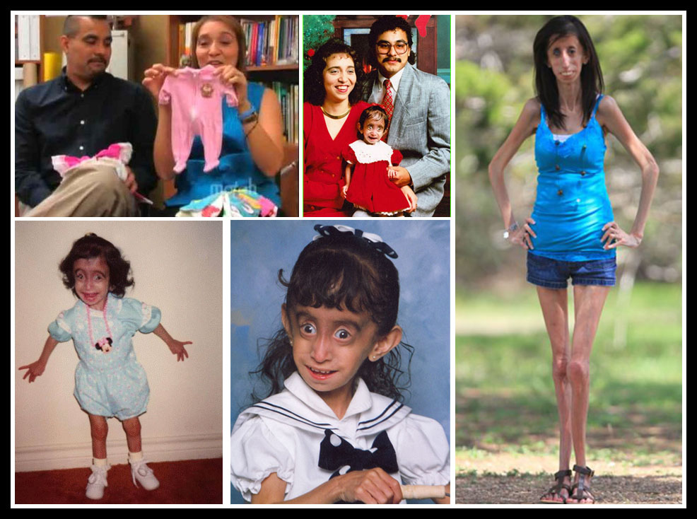 Courage: Born to Inspire (Part 2) - Lizzie Velasquez
