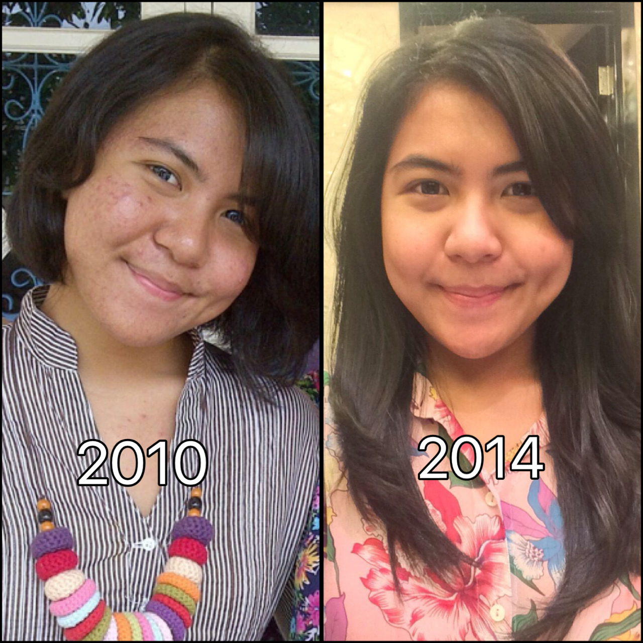 Swietenia Tessa: Review Dokter Kulit Bagus untuk Wajah Jerawat dan Flek ...