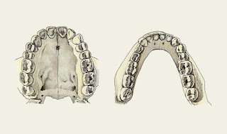 DENTICION PERMANENTE: CONCEPTO: DENTICIÓN PERMANENTE