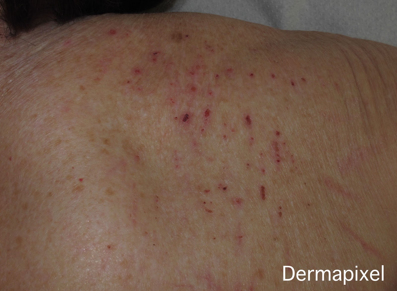 Dermapixel: febrero 2020