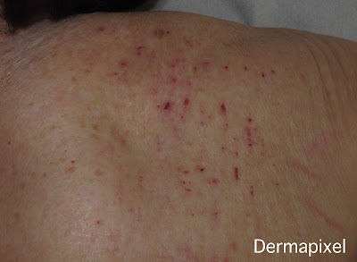 Dermapixel: febrero 2020