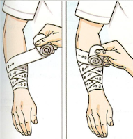 Primeros Auxilios: VENDAJES