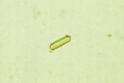 [Haematology] Microscopic Examination of Urinary Sediment - Crystals ...