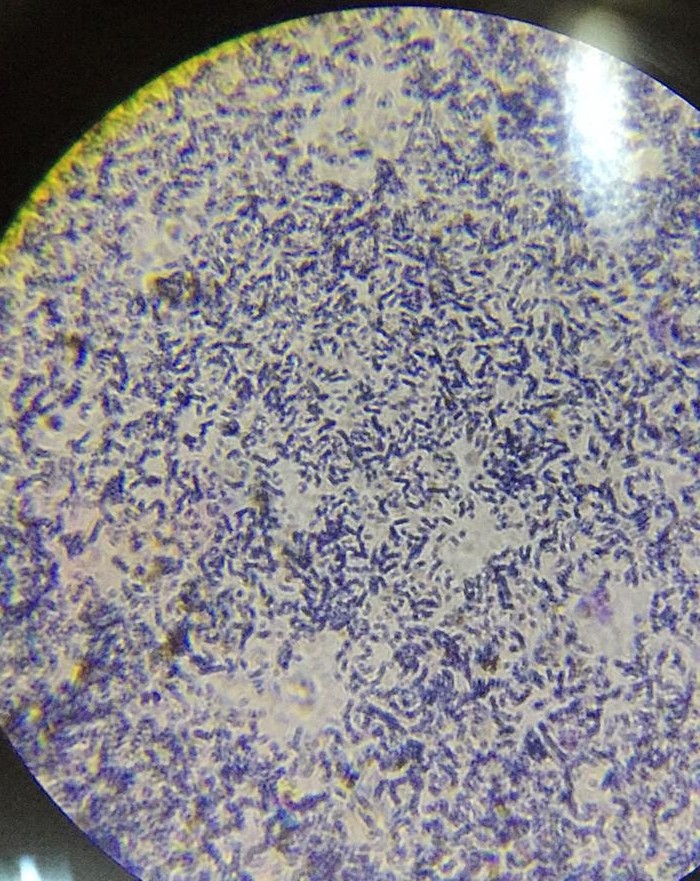 mikrobiologi kelompok 5: PENGAMATAN MAKROSKOPI DAN MIKROSKOPI KOLONI ...