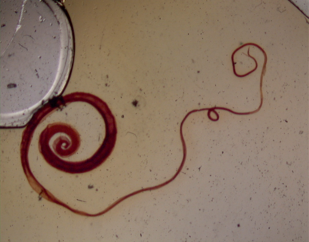 Parasitoses Intestinais - Vermes Que se Alojam no Intestino - Saúde ...