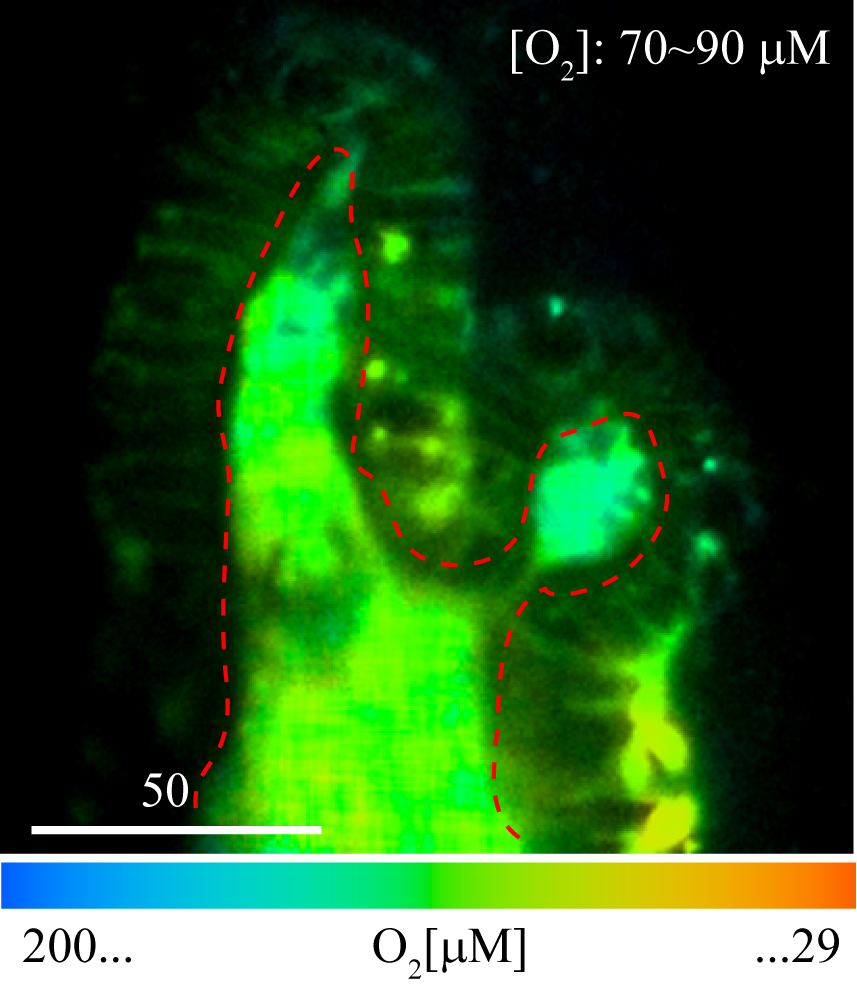 Live cell imaging of mouse intestinal organoids reveals heterogeneity ...