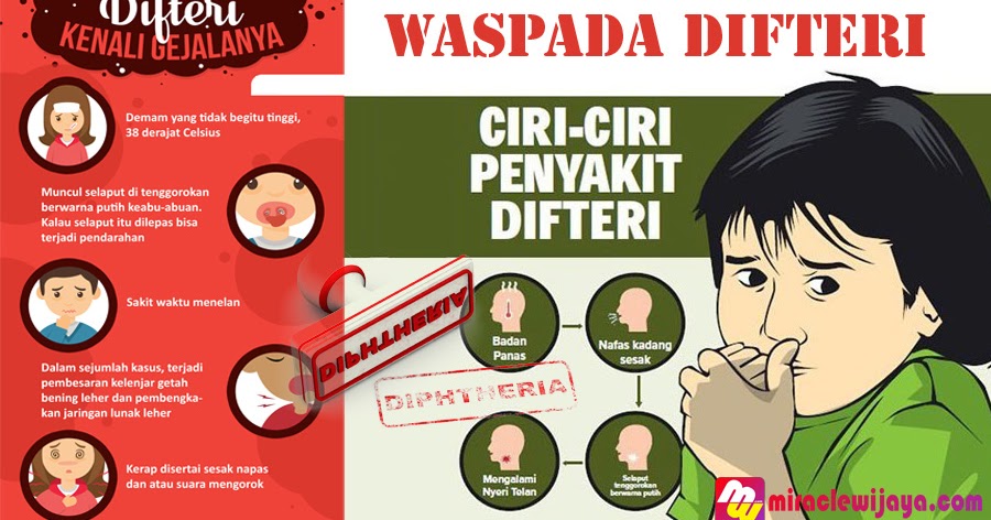Penyakit Difteri - Gejala dan Pengobatan Dengan Vaksin Difteri ...
