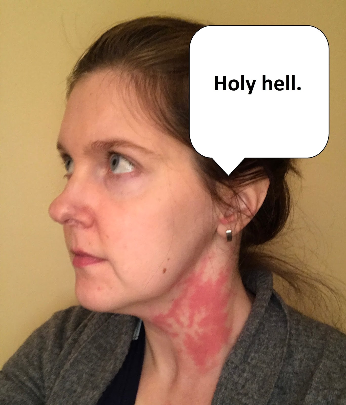 When stress explodes, scars you, and frightens young children. | Noodleroux