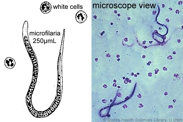 SatuHati8_8SatuCinta: Wuchereria bancrofti (Cacing Filaria)