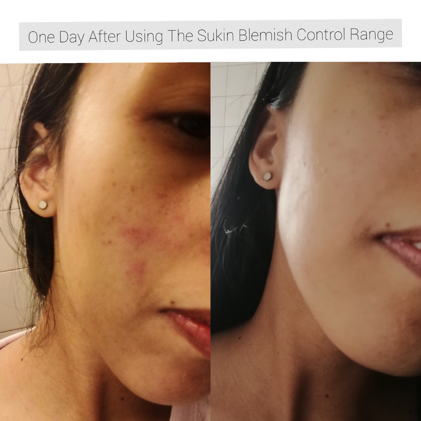 TheFabulosityDiary: Review : Sukin Blemish Control Starter Kit