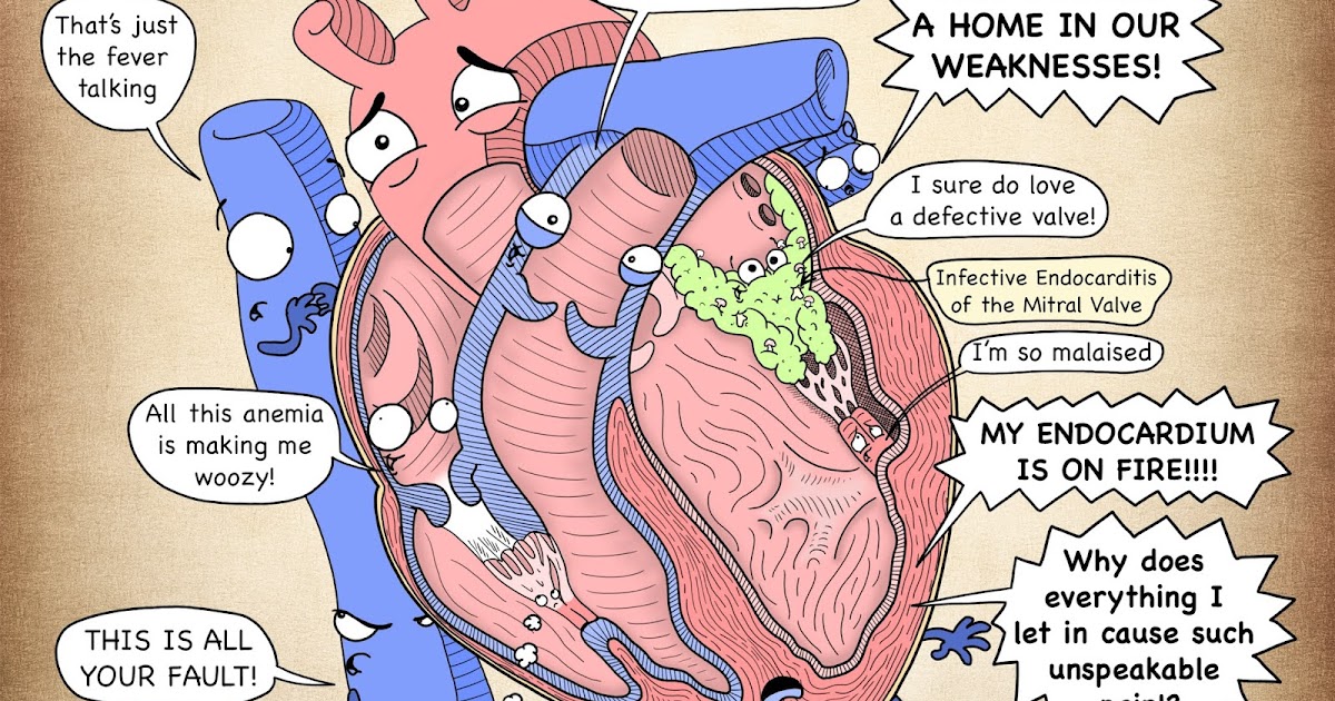 Med4yu: Infective Endocarditis