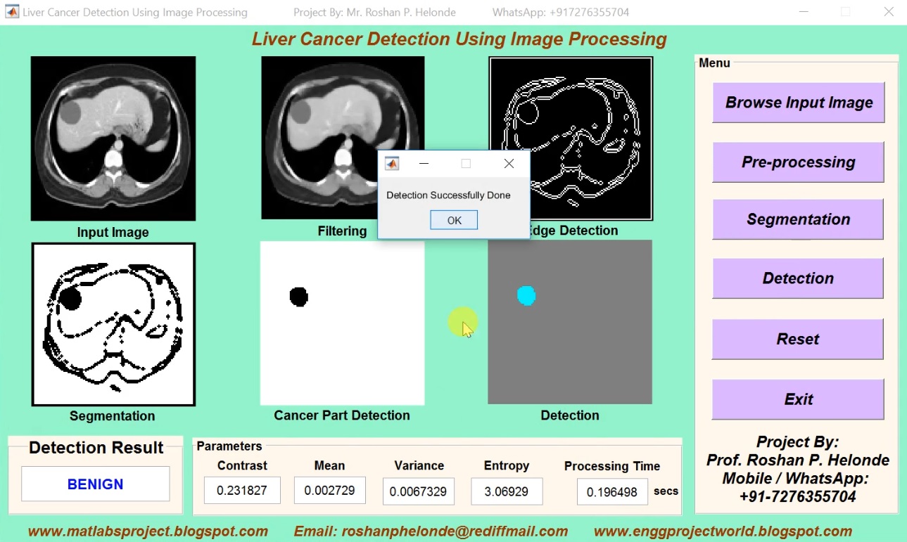 Matlab Code For Liver Cancer Detection Using Image Processing Full