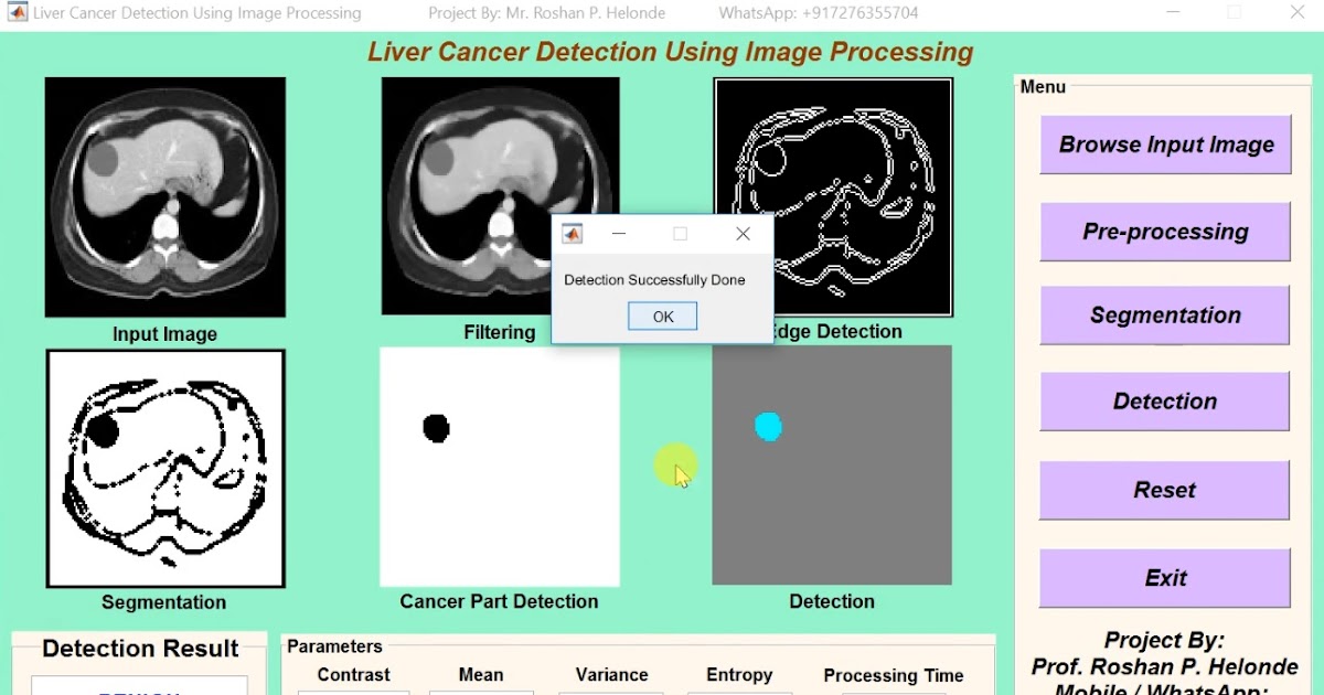 Matlab Code for Liver Cancer Detection Using Image Processing Full ...