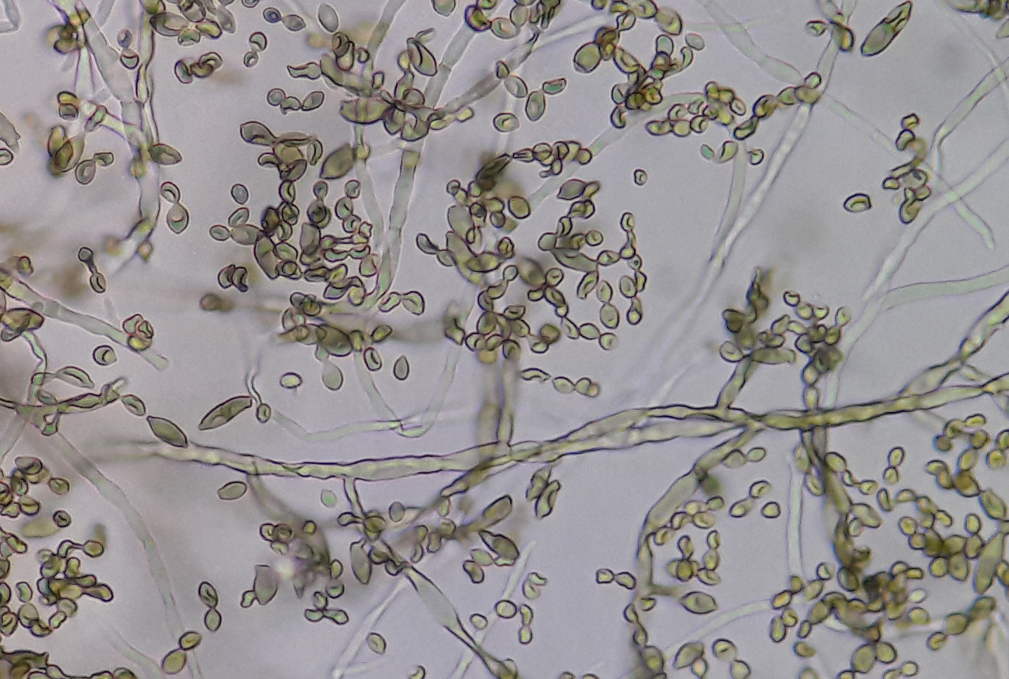 Cheese Mold Under Microscope