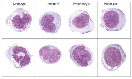 Hematología Fichas: SERIE MONOCITICA