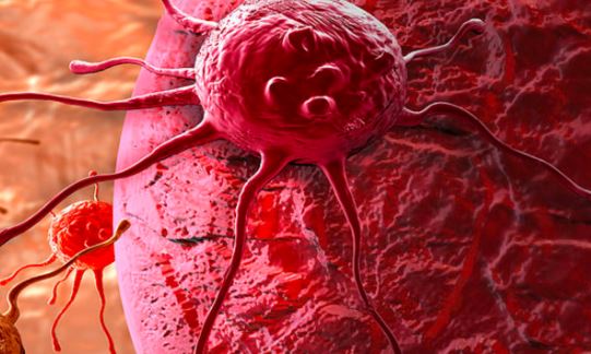 Nutrición y Salud: ¿Qué es el Cáncer?