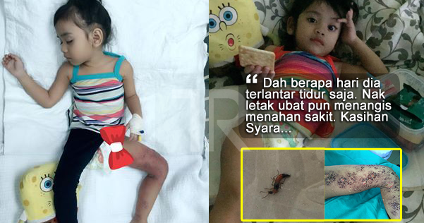 Bahana 'Semut Charlie Punya Angkara' !! Apa sudah jadi dengan Adik ...