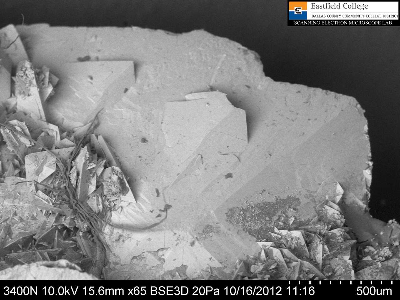 Scanning Electron Microscope Blog: A Kidney Stone - OUCH!!
