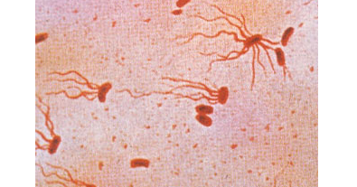 Salmonella sps (S. typhimurium and S. paratyphi): Notes on Typhoid ...