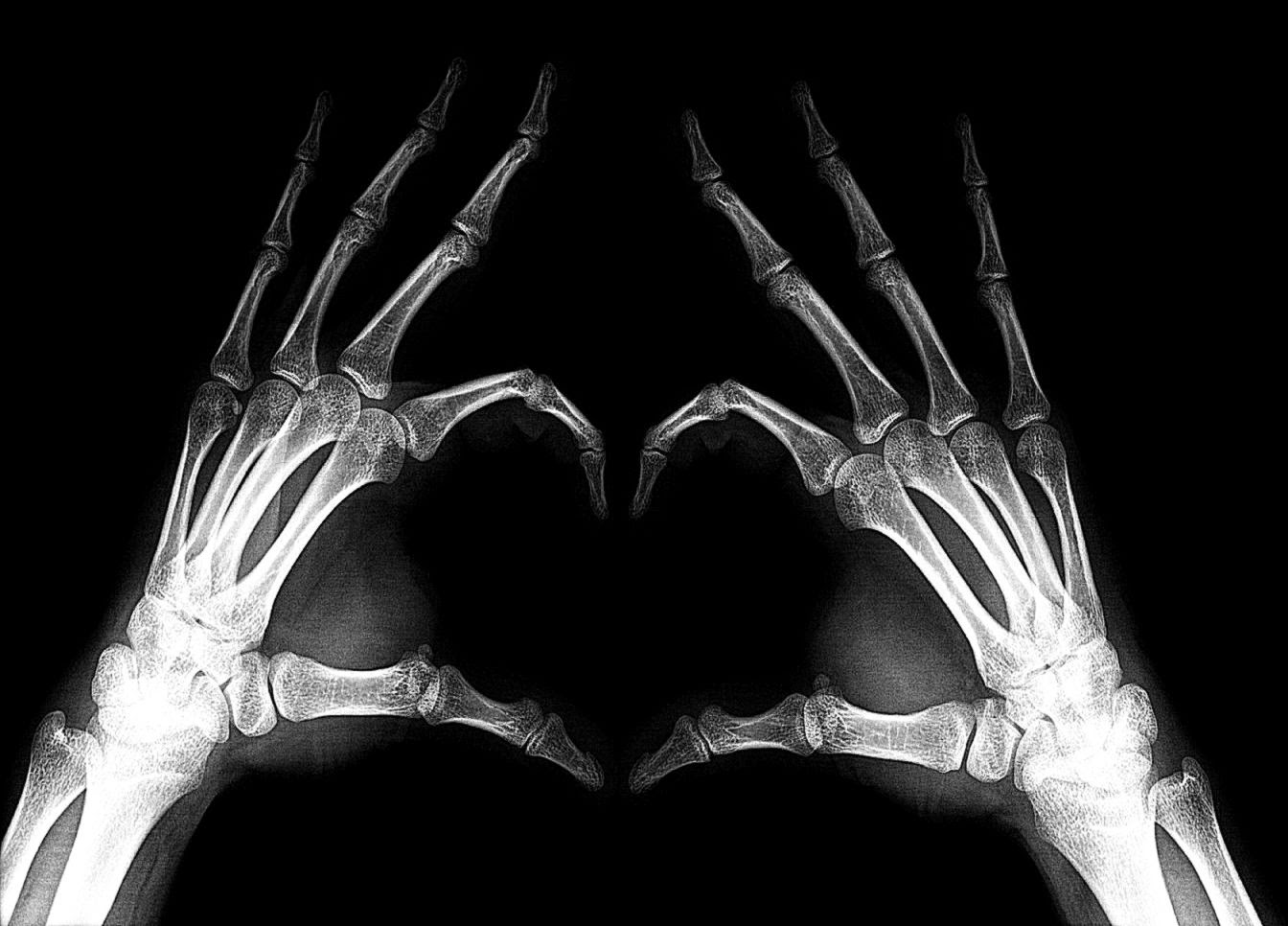 Kualitas Gambar Radiograf