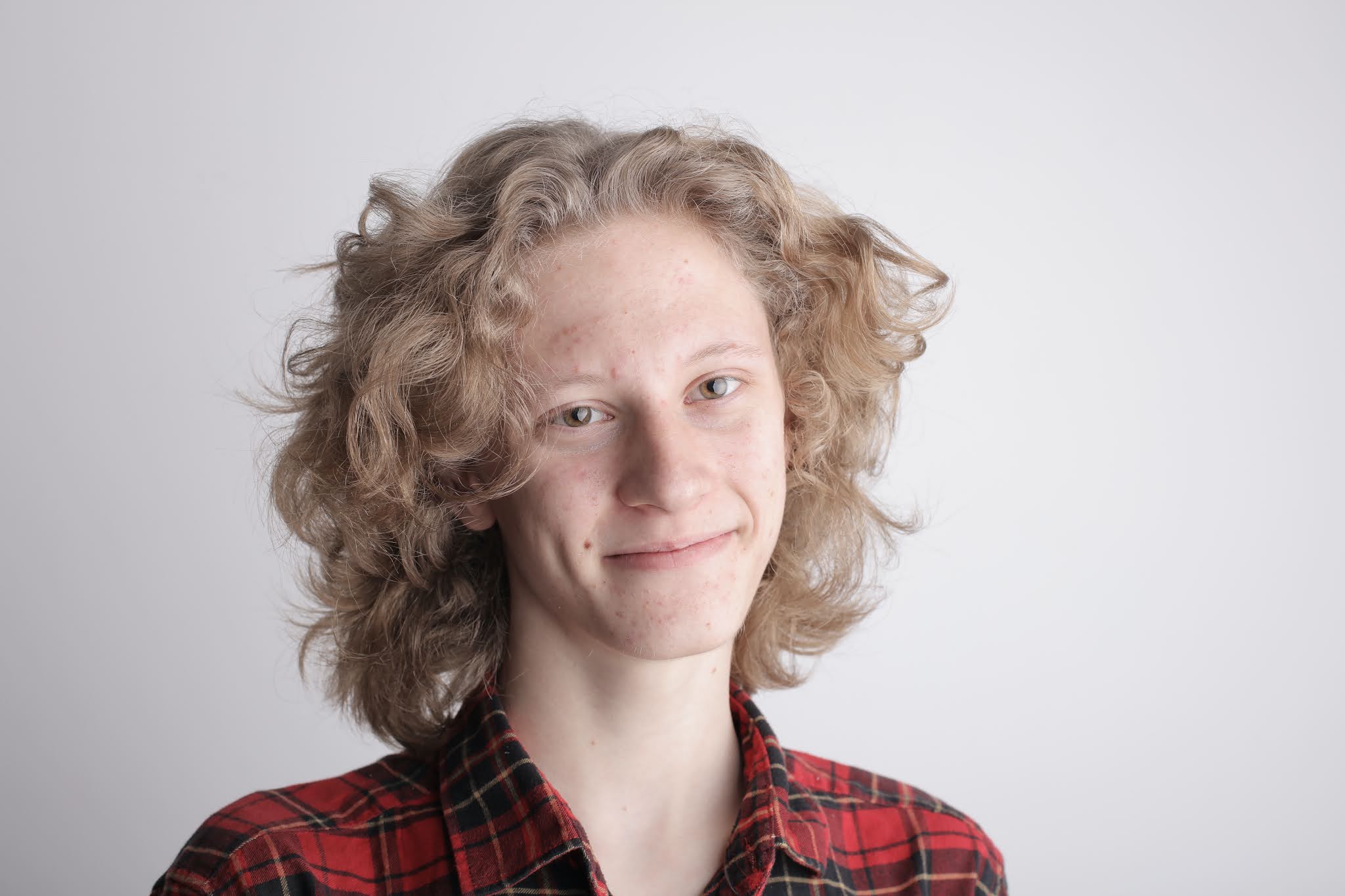 How to get Dimples on face and chin| get dimples on face permanently at ...