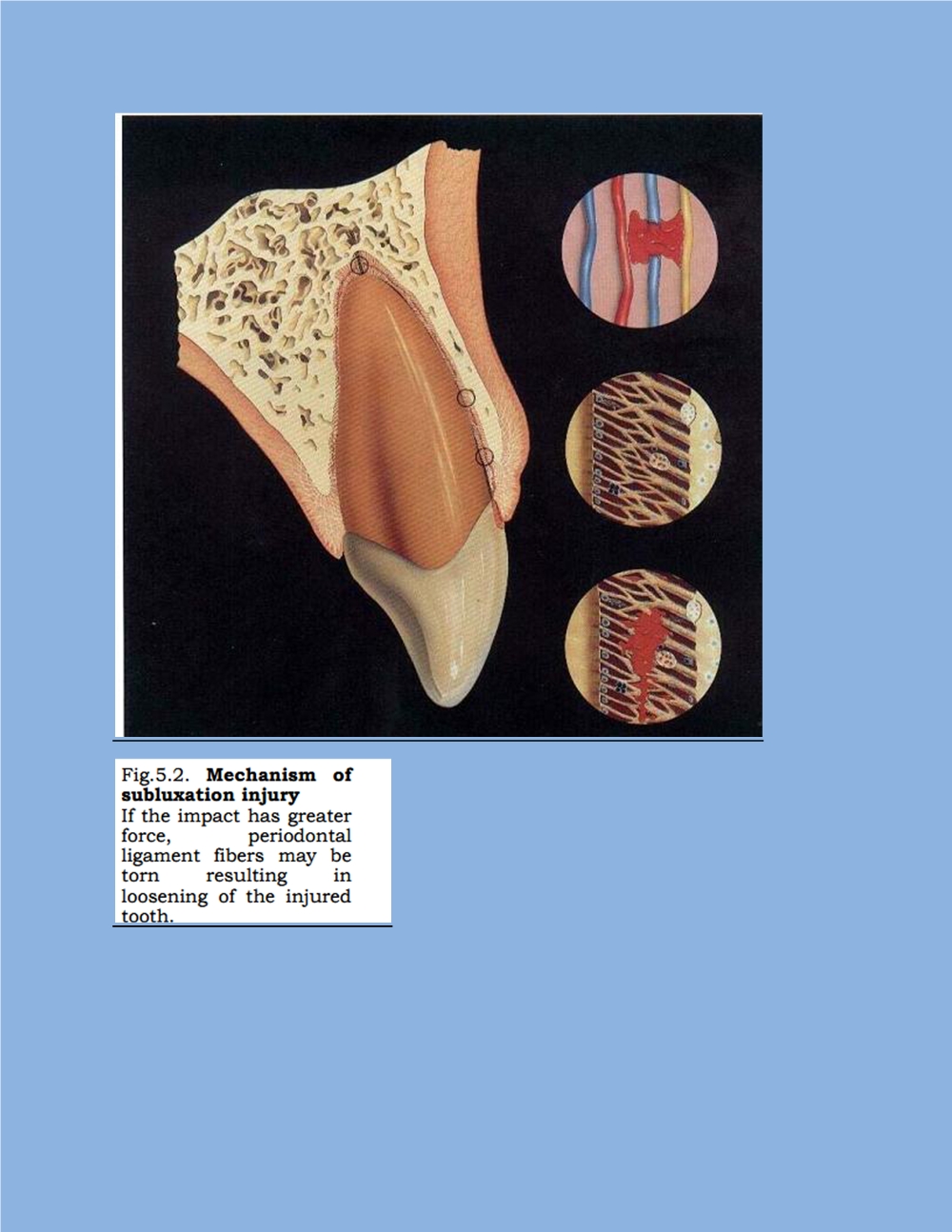 DOs and DONTs in DENTISTRY: CONCUSSION ,SUBLUXATION,EXTRUSION ,LATERAL ...