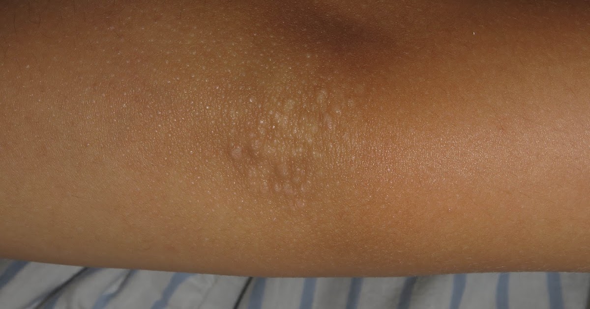 Dermapixel: Lo más visto de 2019 en Dermapixel