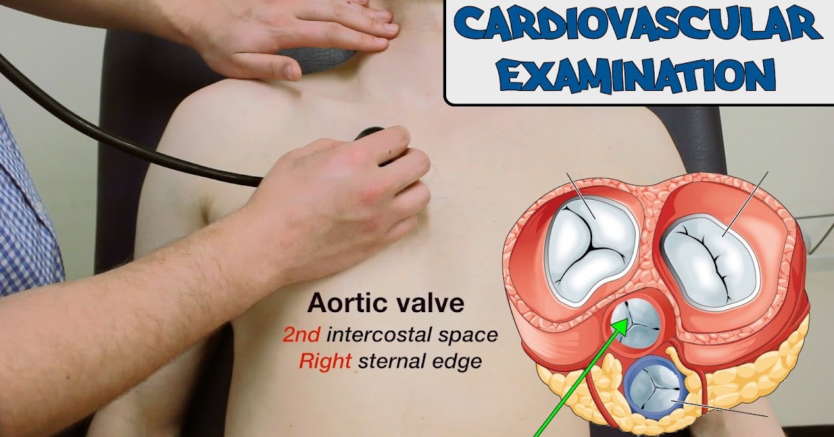 Cardiovascular Examination | Your Medical Advices