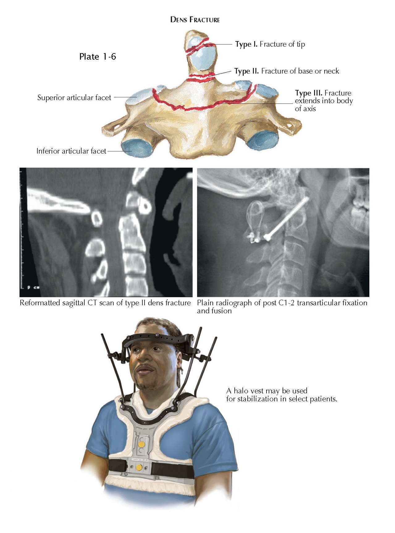 CLINICAL PROBLEMS AND CORRELATIONS OF CRANIOVERTEBRAL JUNCTION ...