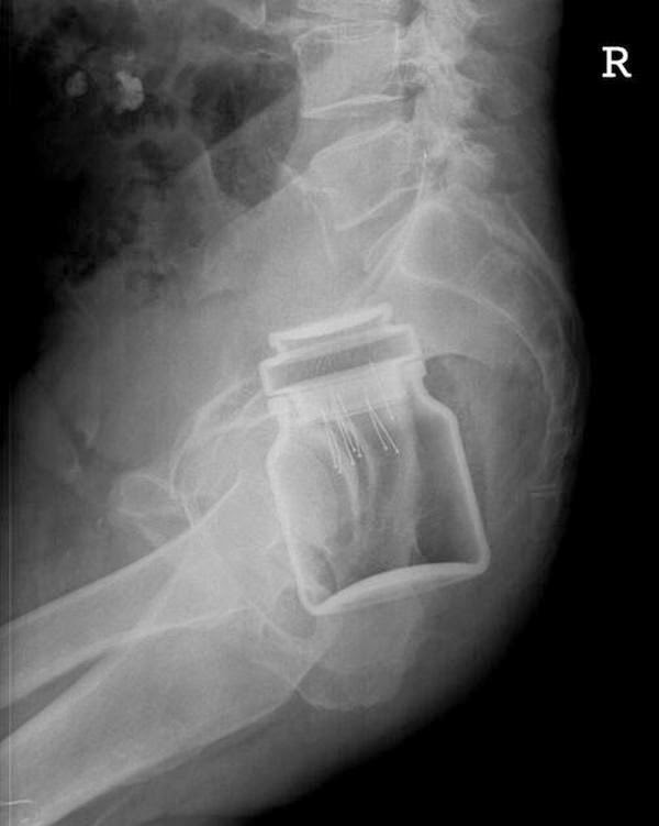 Radiopaedia: a wikipédia das radiografias