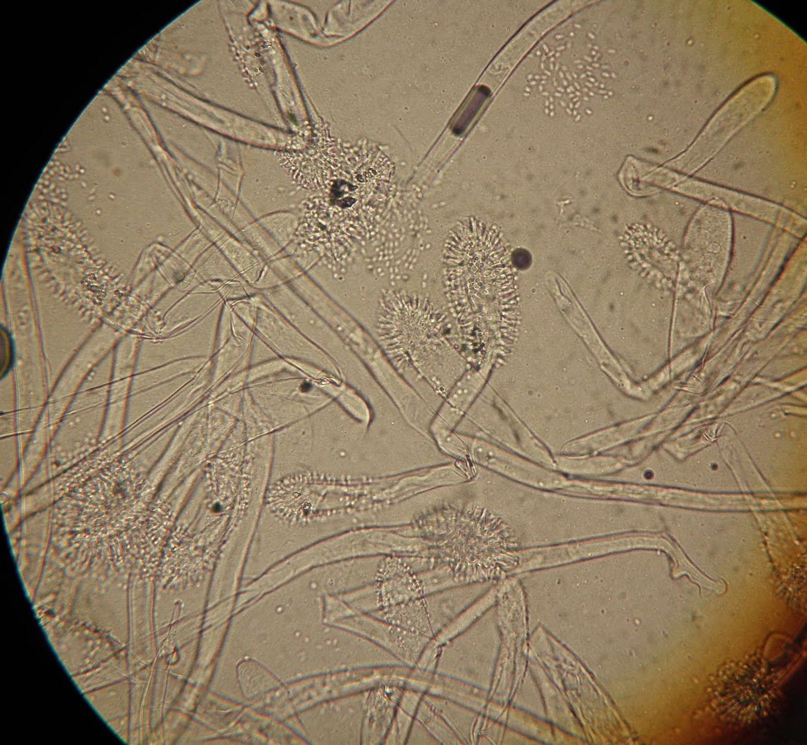 ATLAS MICOLOGIA: ASPERGILLUS CLAVATUS