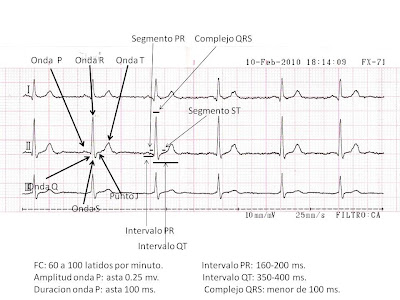 Coniecturalem Artem Esse Medicinam: ECG sus elementos y valores normales