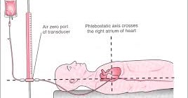 Nursing: measuring central venous pressure CVP