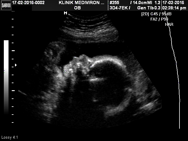 Klinik Mediviron Bandar Bukit Mahkota: Klinik Mediviron Bandar Bukit ...