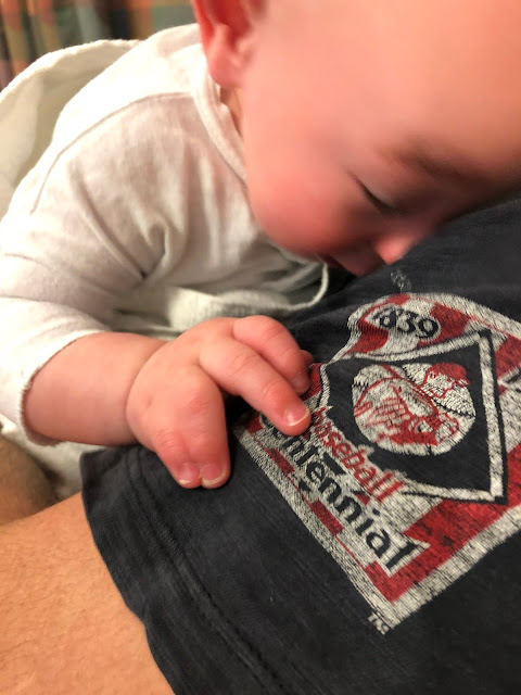 Syndactyly as part of a syndrome | Congenital Hand and Arm Differences ...