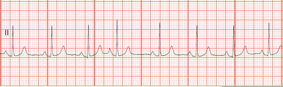 Float Nurse: March 2019